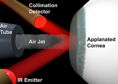 Ocular Response Analyzer® (2.ª generación)