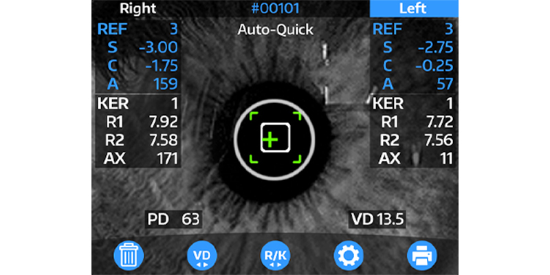 OptoChek® Plus - 自动屈光计 + 角膜曲率计