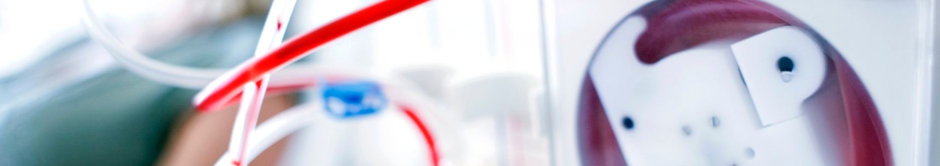 Critical Sensors for Hemodialysis